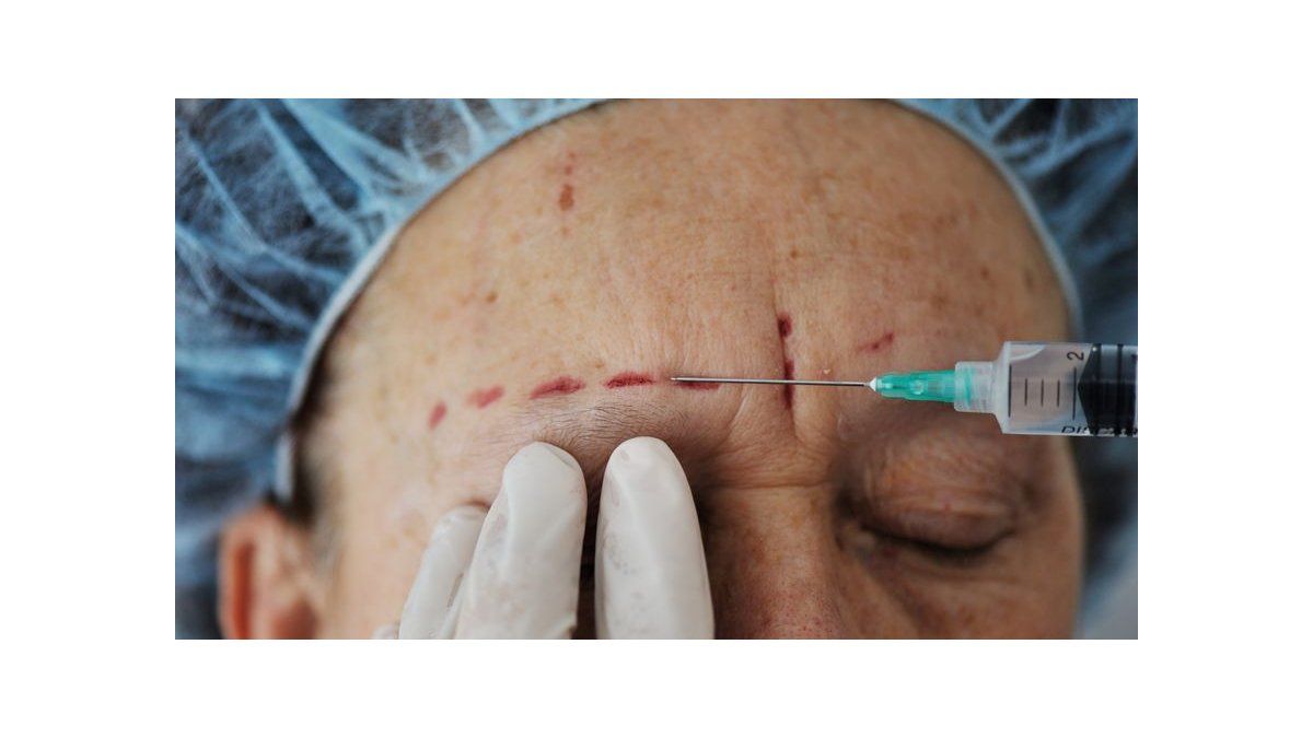 Brasil identifica un lote de botox falso y prohíbe su uso
