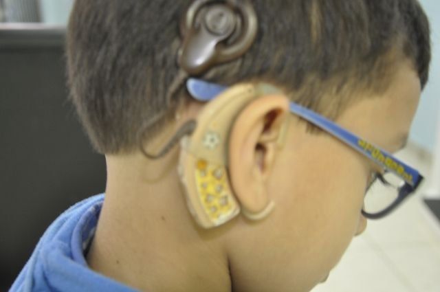 Inicia Programa de Implantes Cocleares 2014