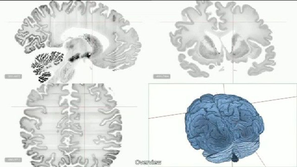 Crean el mapa del cerebro humano más detallado de la historia