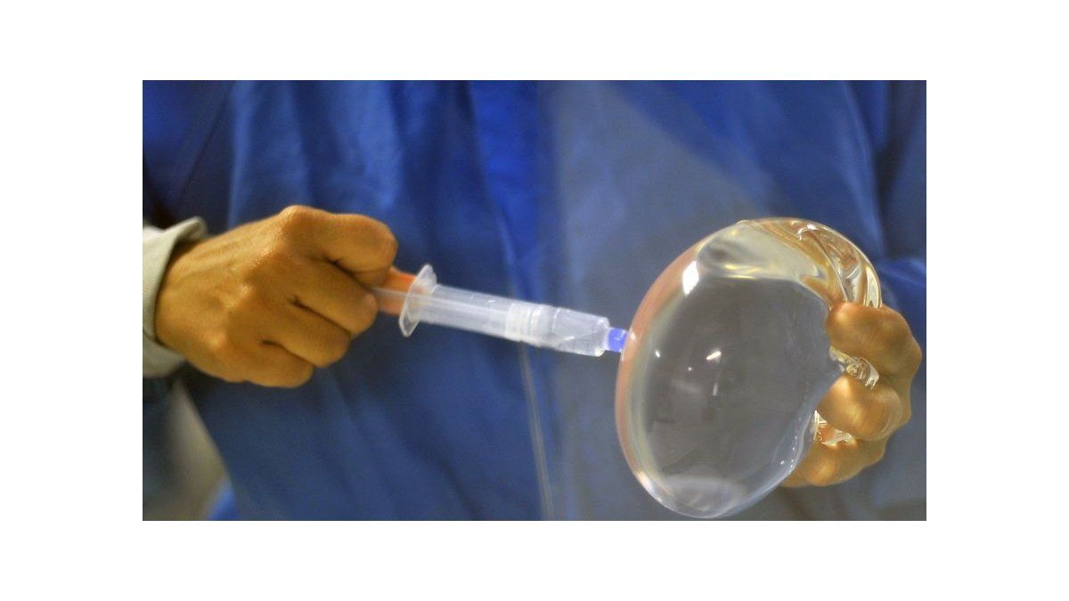 Fabricante brasileño Silimed afirma que sus implantes son seguros