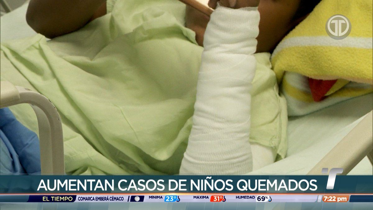 Aumentan las atenciones por quemaduras en el Hospital del Niño