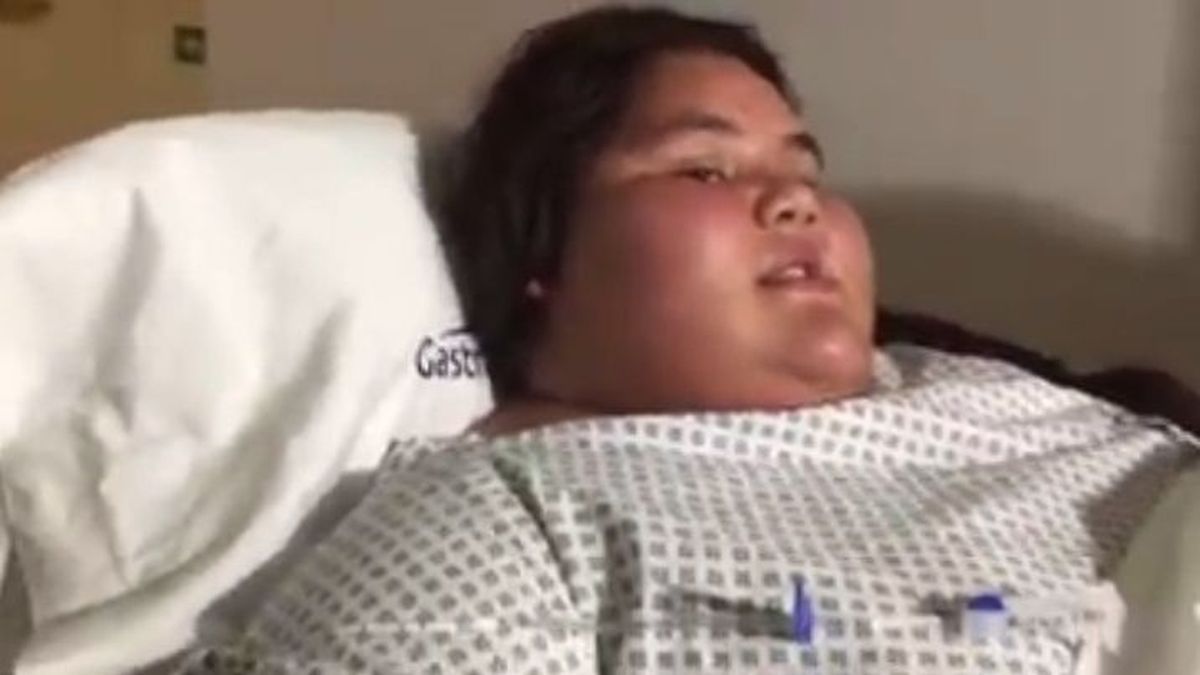 Operan con éxito en México a la adolescente más obesa del mundo
