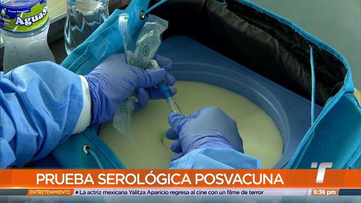 Científicos explican utilidad de las pruebas serológicas tras vacunación