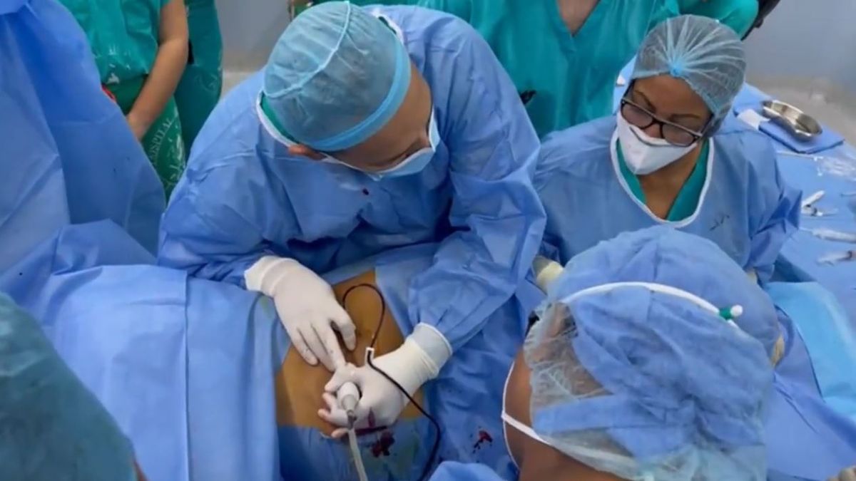 Realizan por primera vez en el sistema público de salud transfusión ...