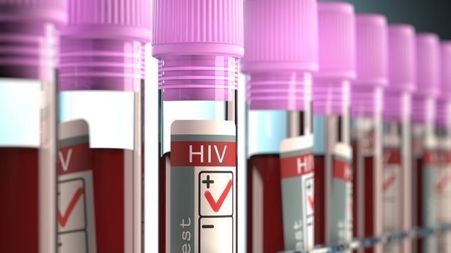 Probidsida registra 36 casos positivos de VIH en enero y 28 en febrero