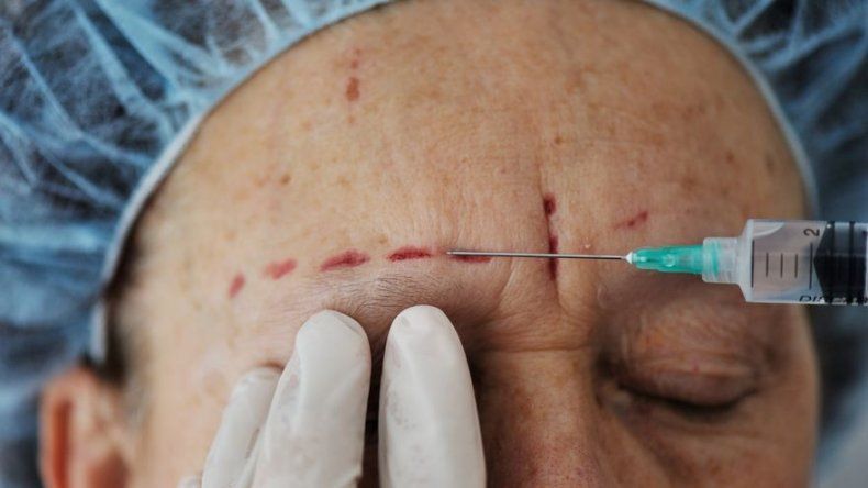 Brasil identifica un lote de botox falso y prohíbe su uso