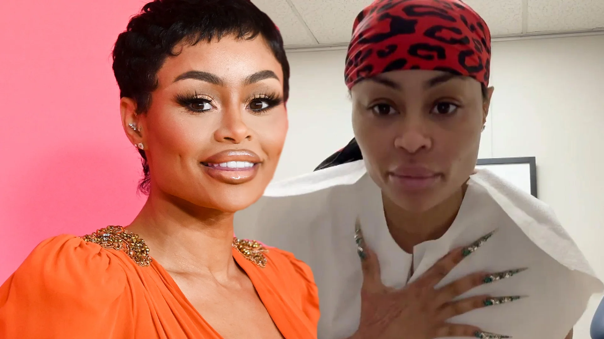 Blac Chyna se quitó los implantes en pecho y glúteos