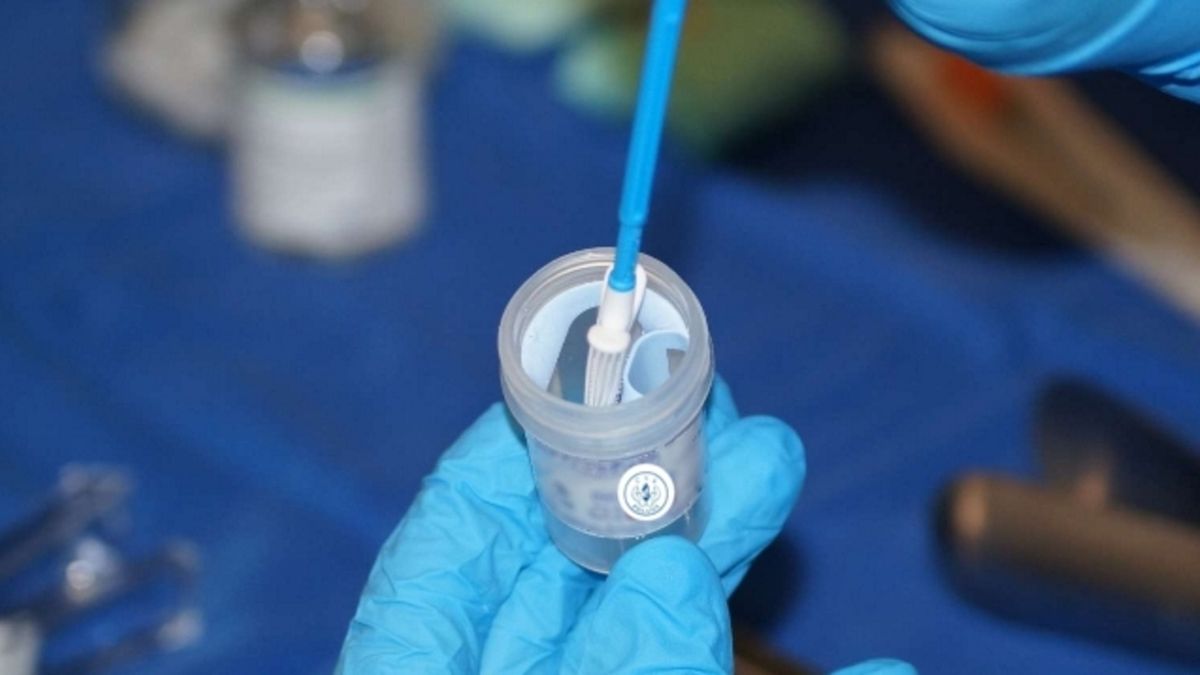 ¿Qué es el VPH y cómo prevenirlo?