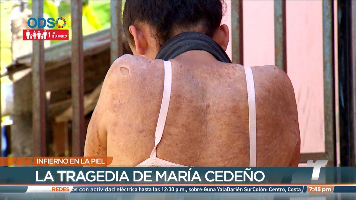 Infierno en la piel, la tragedia de María Cedeño